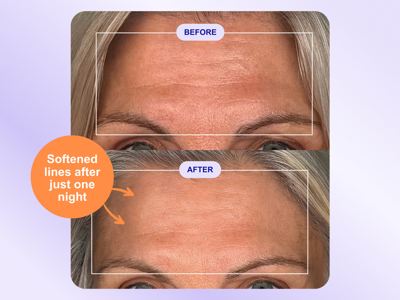 Wrinkle Patches for Smooth, Event-Ready Skin – Wrinkles Schminkles UK